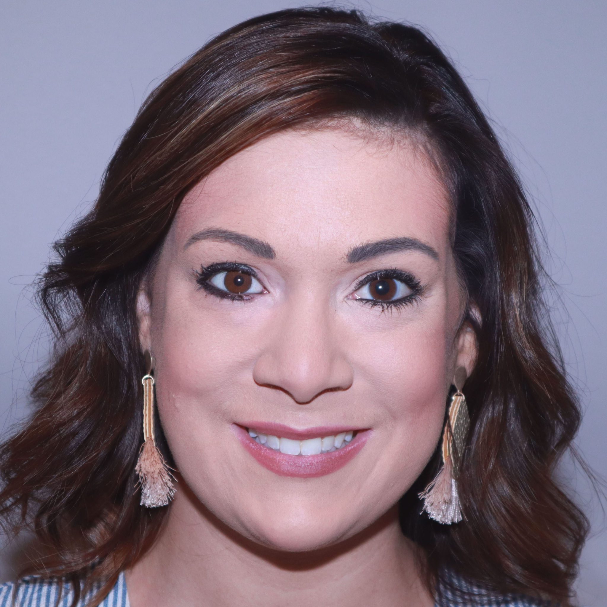 Corneal Scleral Shells | Carolina Eye Prosthetics