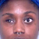 Prosthetic Eye Patient Photos | Carolina Eye Prosthetics