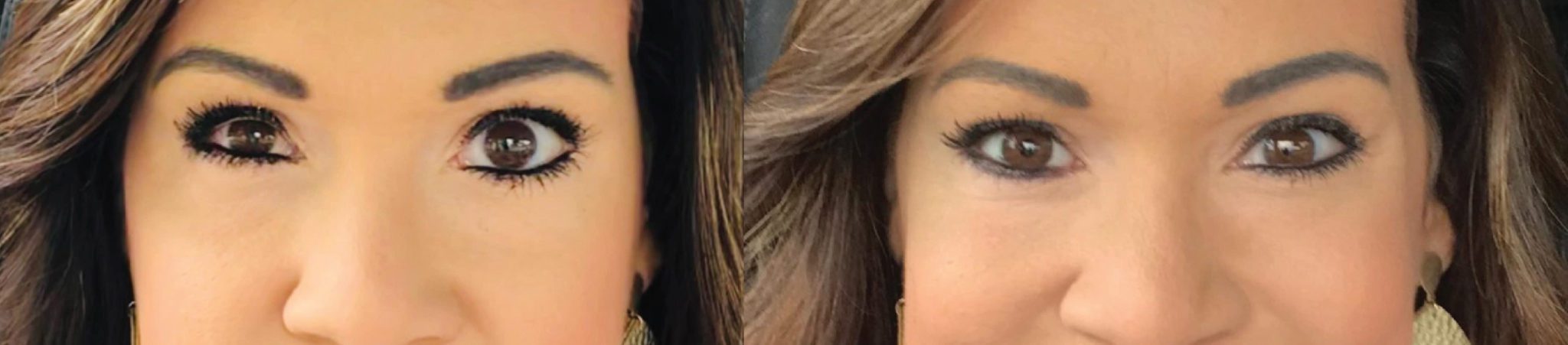 How to Improve Your Quality of Life After Vision Loss